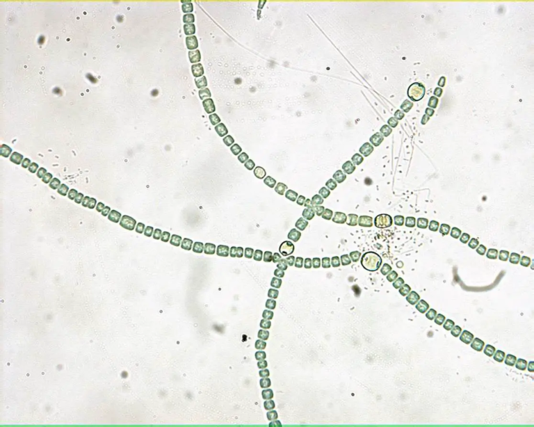 Anabaena Under Microscope - Biology Notes Online