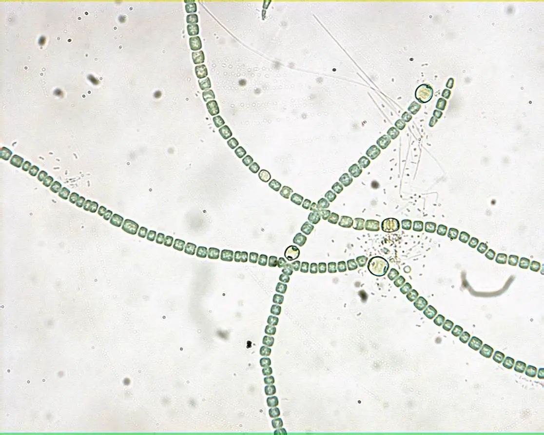 Anabaena Under Microscope - Biology Notes Online