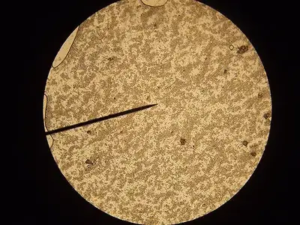 Yeast Under the Microscope - Biology Notes Online