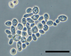 Yeast Under the Microscope - Biology Notes Online
