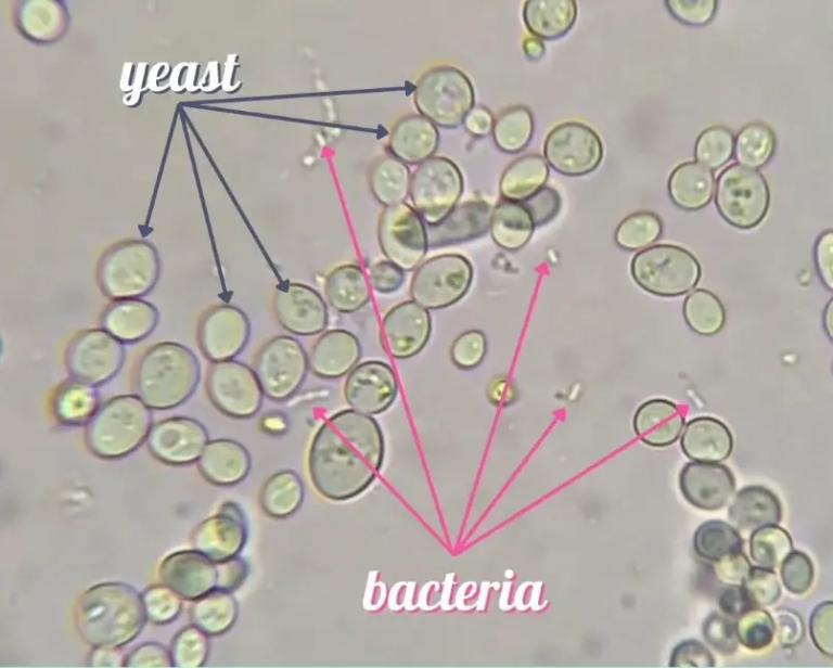 Yeast Under the Microscope - Biology Notes Online