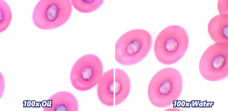 Polarizing Microscopes - Principle, Parts, Procedure, Uses - Biology ...