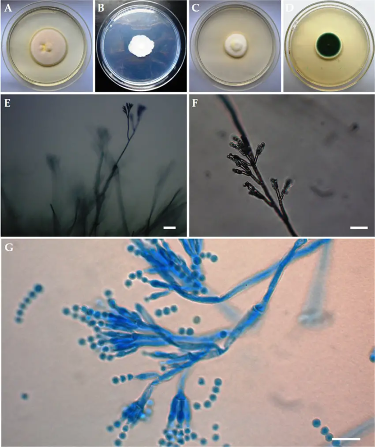 Penicillium chrysogenum - Morphology, Habitat, Characteristics ...