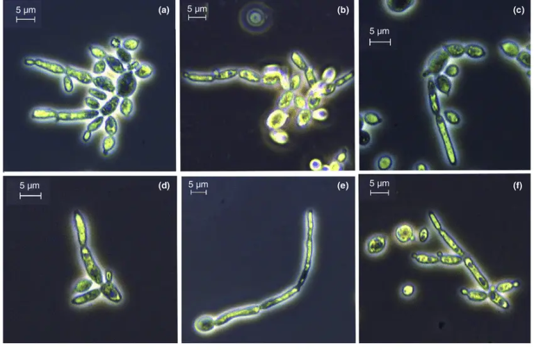 Candida tropicalis - Morphology, Pathogenesis, Transmisssion, Treatment ...