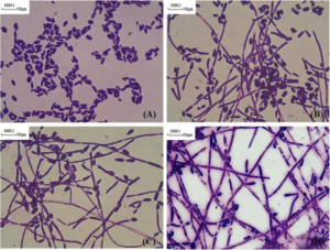 Candida tropicalis - Morphology, Pathogenesis, Transmisssion, Treatment ...