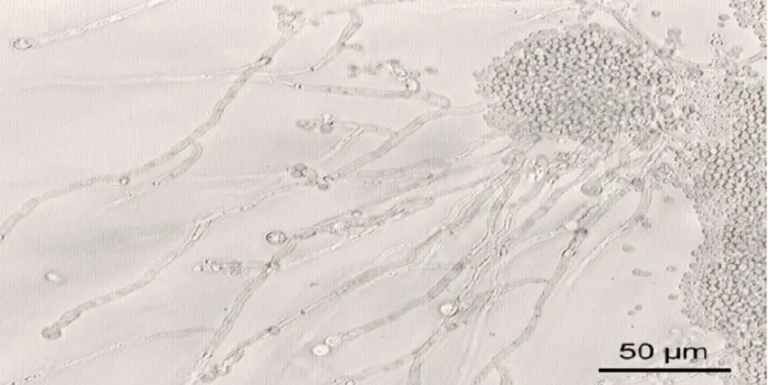Candida parapsilosis - Morphology, Pathogenesis, Transmission ...