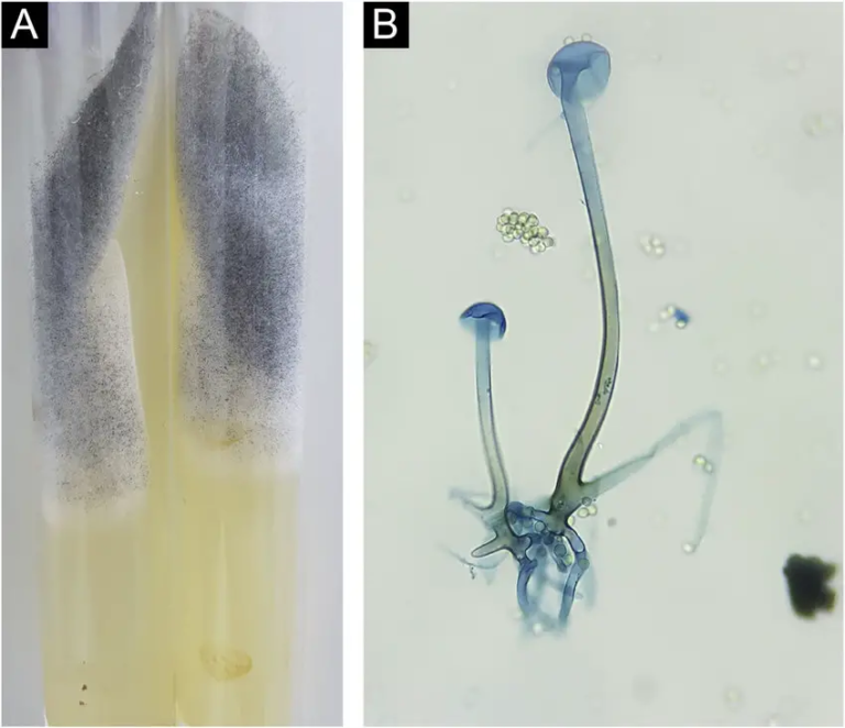 Rhizopus microsporus - overview - Biology Notes Online