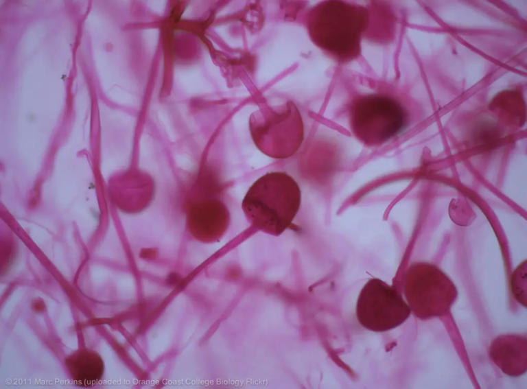 Rhizopus spp - Structure, Life cycle, Habitat, Pathogenesis - Biology ...