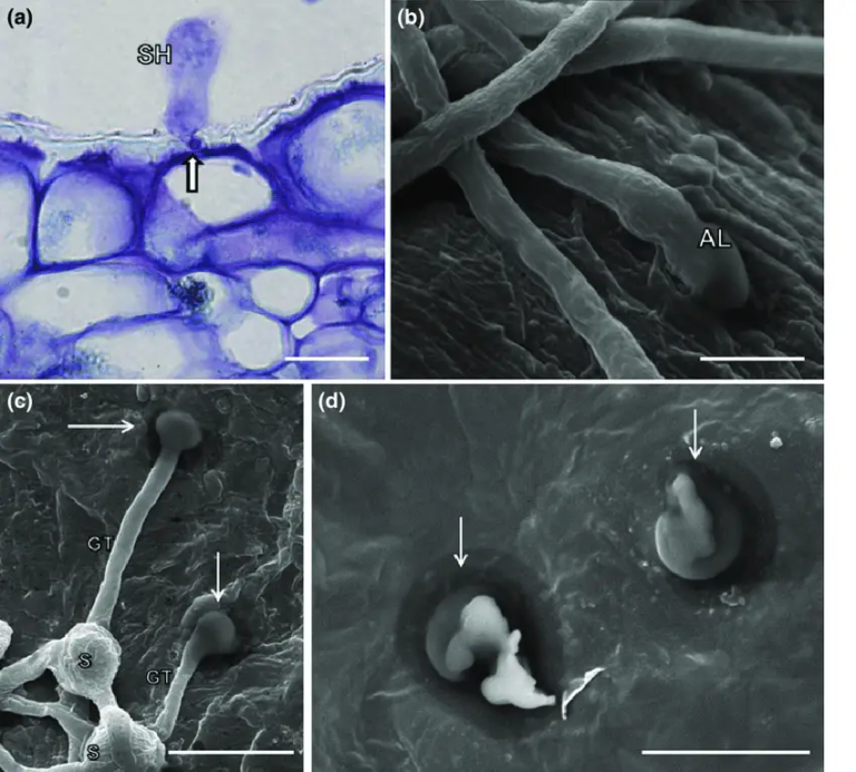 Rhizopus spp - Structure, Life cycle, Habitat, Pathogenesis - Biology ...