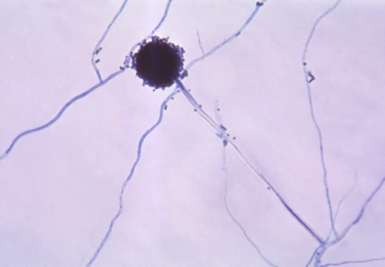 Hyphae Definition Types Structure Production Functions Examples Biology Notes Online