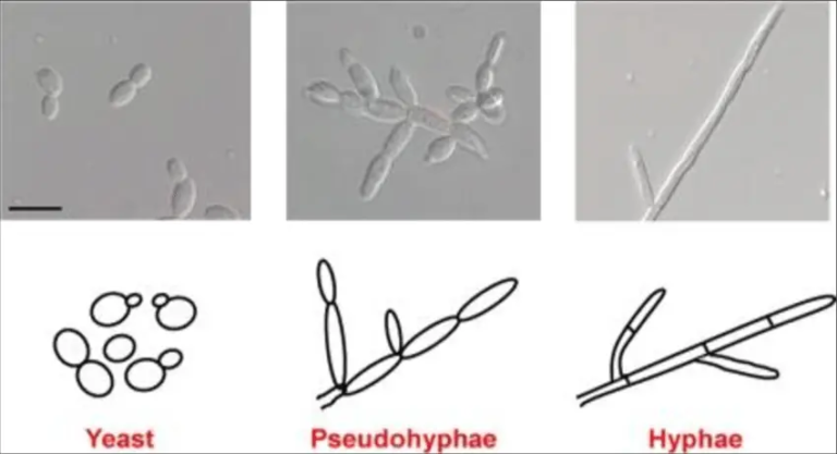 Candida albicans - Morphology, Life Cycle, Pathogenesis, Treatment ...