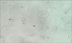 Candida albicans - Morphology, Life Cycle, Pathogenesis, Treatment ...