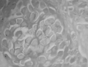 Poxviruses - Definition, Classification, Morphology, Life Cycle ...