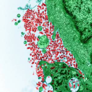 Rabies Virus - Structure, Genome Organization, Pathogenesis ...
