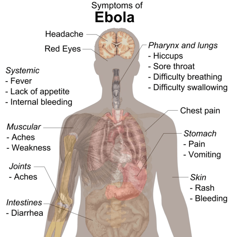 Ebola Virus Structure Genome Replication Pathogenesis Biology Notes Online