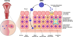 Human Papillomavirus (HPV) - Definition, Structure, Genome, Replication ...