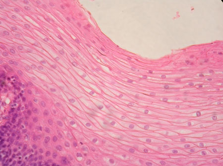 Stratified Squamous Epithelium Function Structure Location And Slide