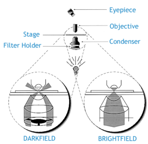 Dark Field Microscopy - Principle, Parts, Procedure, Uses - Biology ...