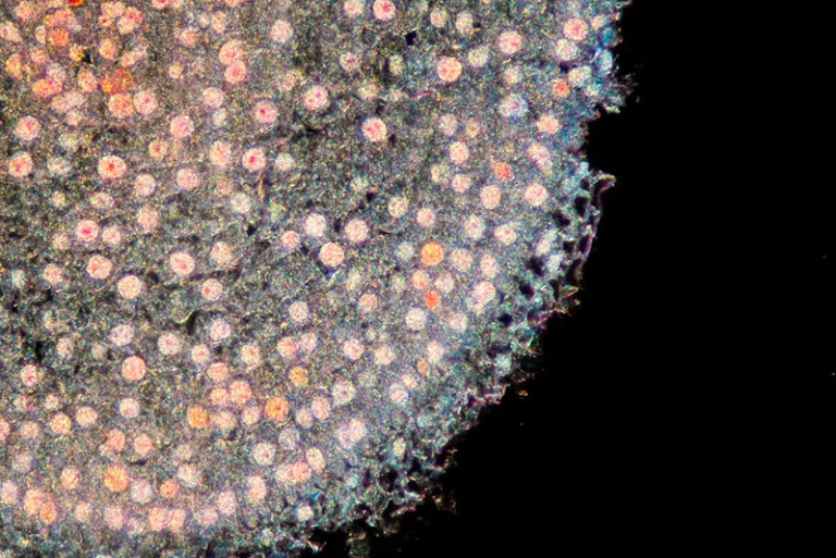 Dark Field Microscopy - Principle, Parts, Procedure, Uses - Biology ...