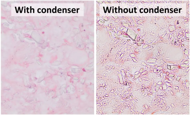 Microscope Condenser - Types, Parts, Mechanism, Uses - Biology Notes Online
