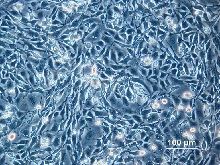 Inverted Microscope - Principle, Procedure, Parts, Uses - Biology Notes ...