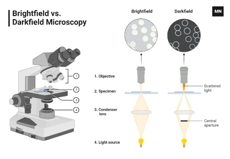 Bright Field Microscope - Definition, Parts, Working Principle ...