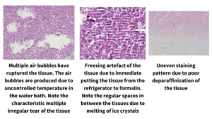 Microtome - Principle, Parts, Types, and Uses - Biology Notes Online