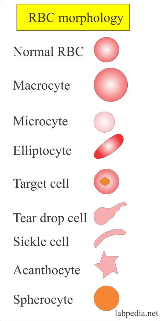 Ovalocytes 1-meaning Red Blood Cell Morphology, Size, Shape, Color