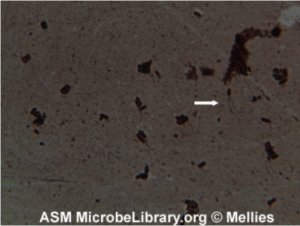 Leifson Technique for Bacterial Flagella Staining - Biology Notes Online