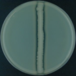 Casein Hydrolysis Test - Principle, Procedure, Result - Biology Notes ...