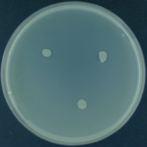 Casein Hydrolysis Test - Principle, Procedure, Result - Biology Notes ...