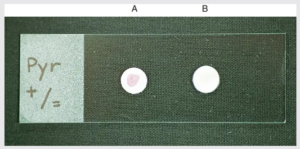 PYR Test (Pyrrolidonyl Arylamidase (PYR) test) - Principle, Procedure ...