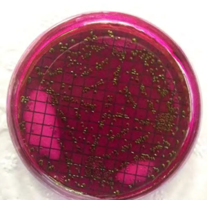 Membrane Filtration Method for Water Quality Analysis - Biology Notes ...