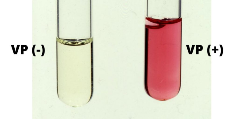 Voges Proskauer (VP) Test - Principle, Procedure, Results - Biology ...