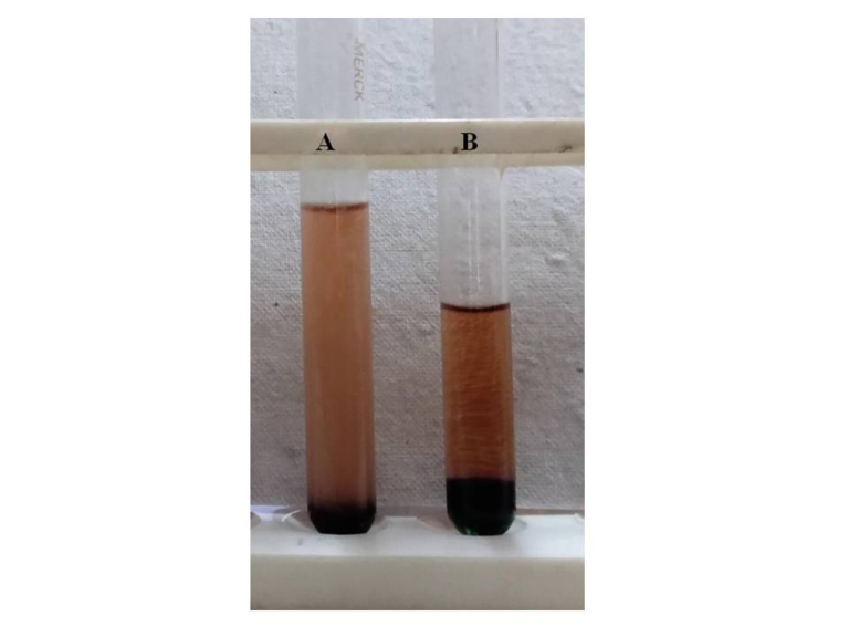 Nylander’s Test for Carbohydrates Principle, Procedure, Result ...