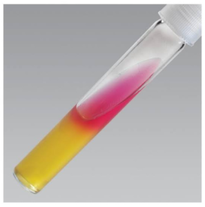 Hydrogen Sulfide (H2S) Test - Principle, Procedure, Result - Biology ...