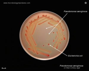 Pseudomonas Aeruginosa on Macconkey Agar - Biology Notes Online