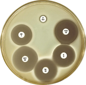 Mueller Hinton Agar (MHA) Composition, Principle, Preparation - Biology ...