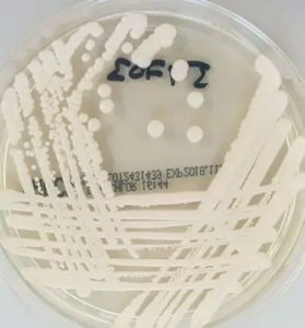 Sabouraud Dextrose Agar (SDA) - Composition, Preparation, Principle ...
