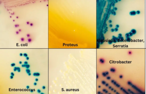 CHROMagar - Composition, Principle, Preparation, Results, Uses ...