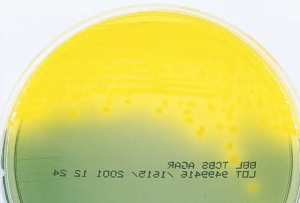 TCBS Agar - Composition, Principle, Preparation, Results, Uses ...
