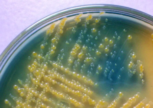 CLED Agar - Composition, Principle, Preparation, Results, Uses ...