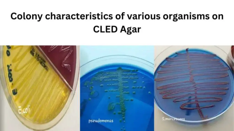 CLED Agar - Composition, Principle, Preparation, Results, Uses ...