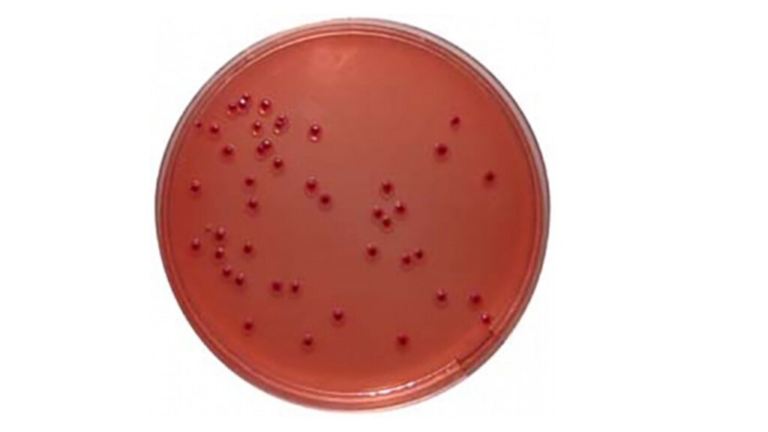 Yersinia Selective Agar - Composition, Principle, Preparation, Results ...