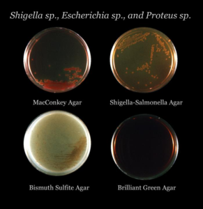 Bismuth Sulphite Agar (BSA) - Composition, Principle, Preparation ...