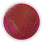 Endo Agar - Composition, Principle, Preparation, Results, Uses ...
