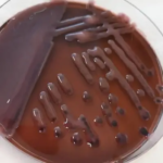 EMB Agar - Composition, Principle, Preparation, Results, Uses - Biology ...
