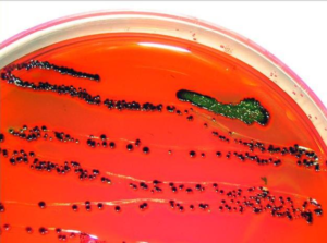 EMB Agar - Composition, Principle, Preparation, Results, Uses - Biology ...