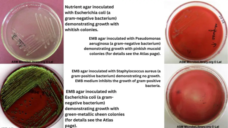 EMB Agar - Composition, Principle, Preparation, Results, Uses - Biology ...