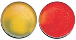 Tryptic Soy Agar (TSA) - Composition, Principle, Preparation, Results ...
